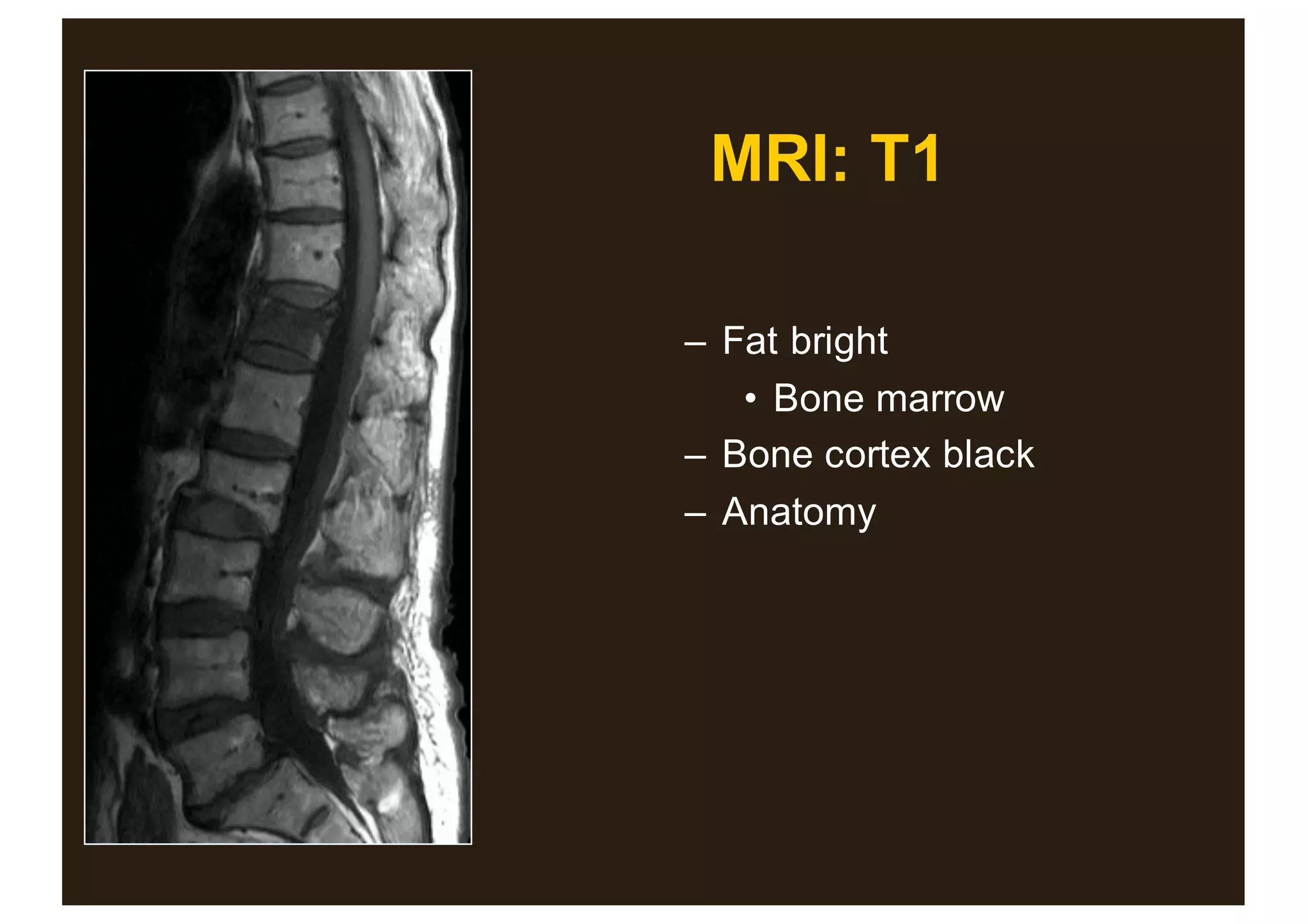 Radiological assessment - Part 1 | PPT