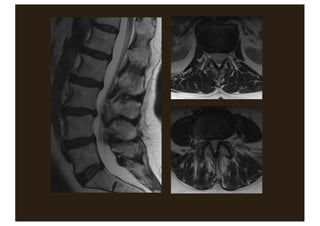 Radiological assessment - Part 1 | PPT
