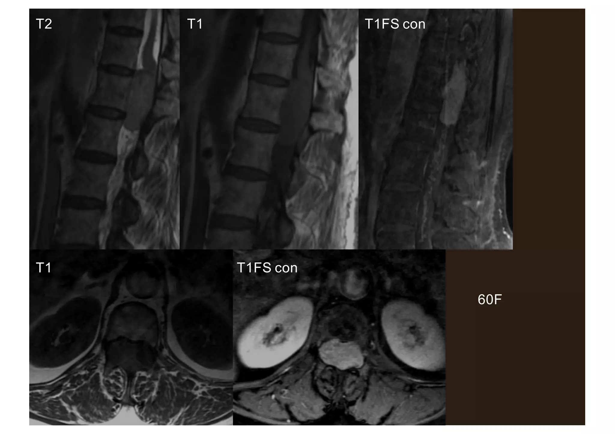 Radiological assessment – Part 2 | PPT