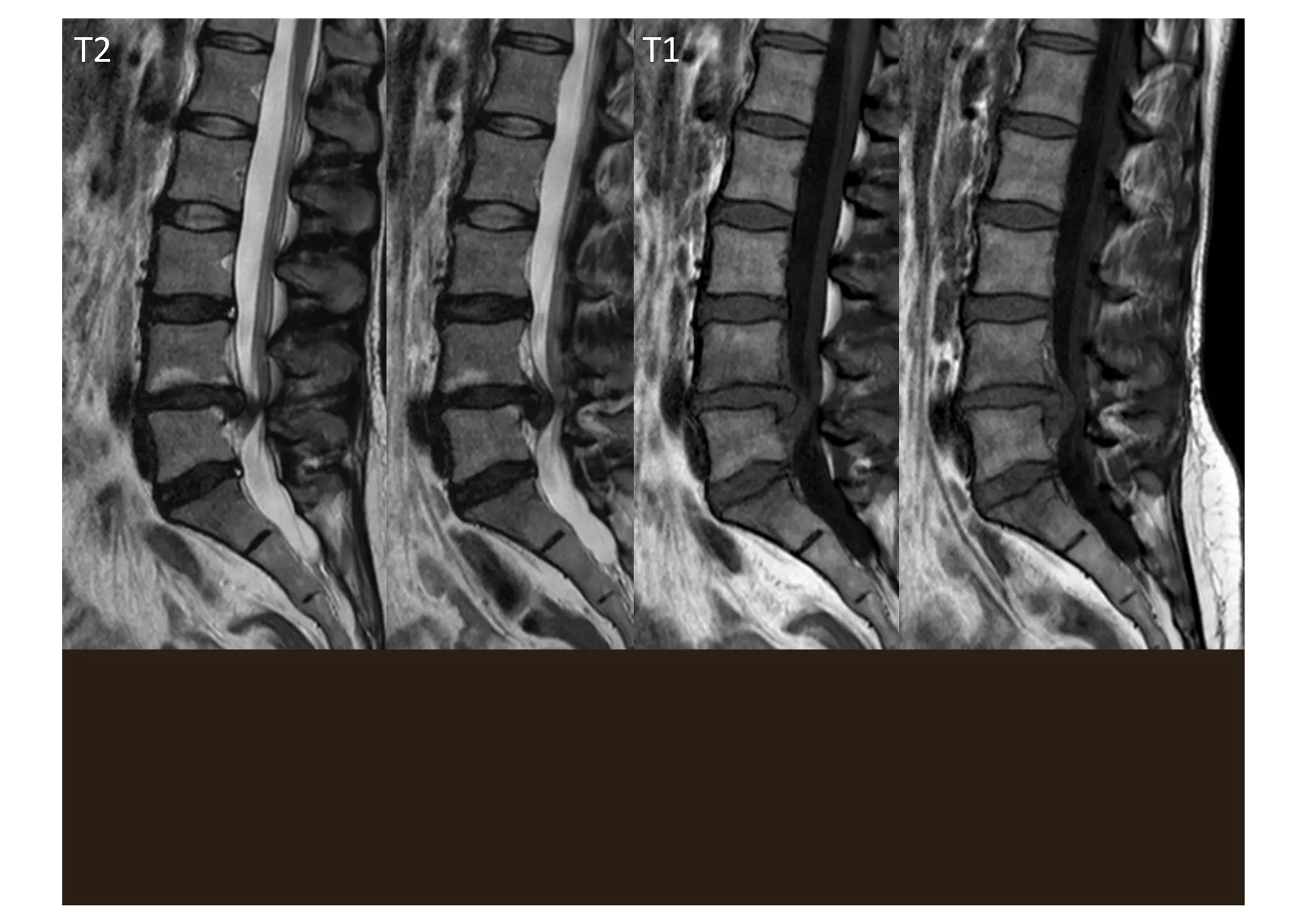Radiological assessment – Part 2 | PPT