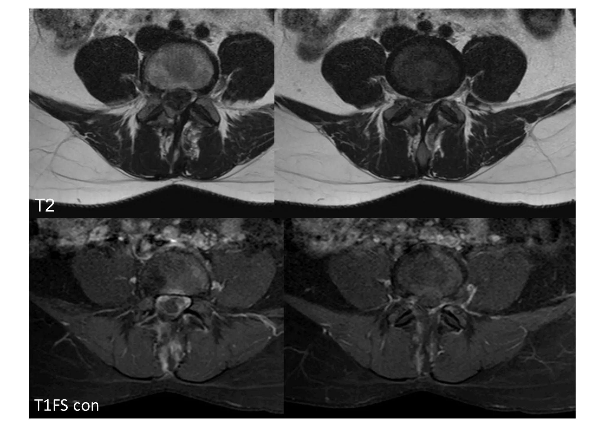 Radiological assessment – Part 2 | PPT