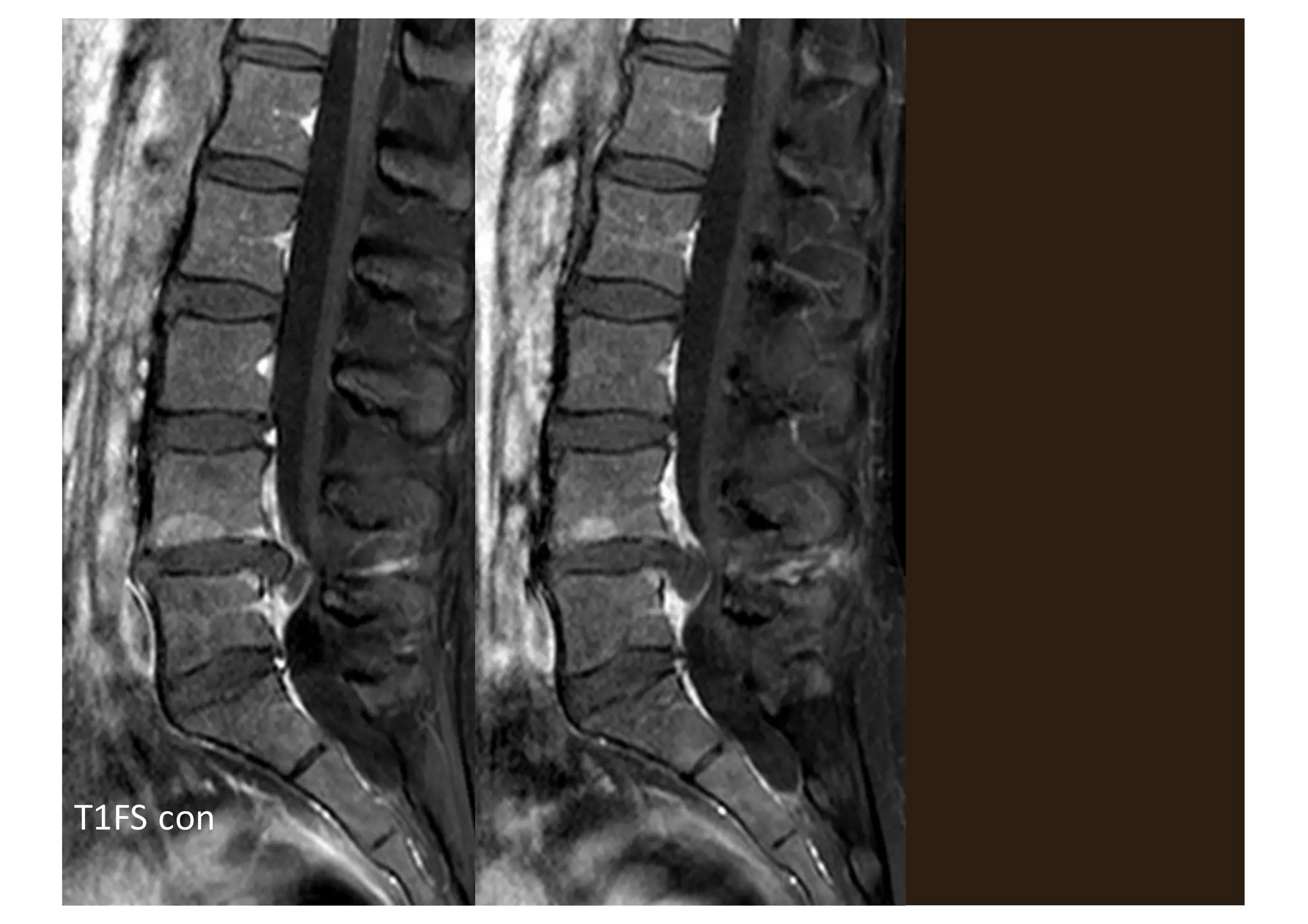 Radiological assessment – Part 2 | PPT