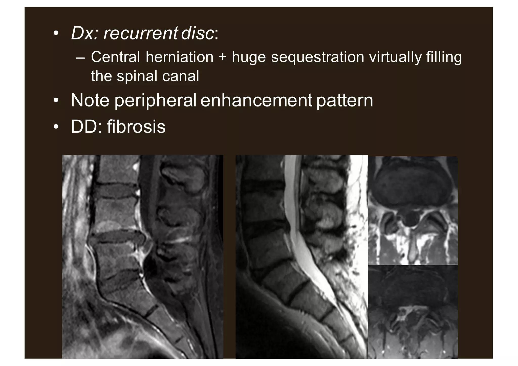 Radiological assessment – Part 2 | PPT