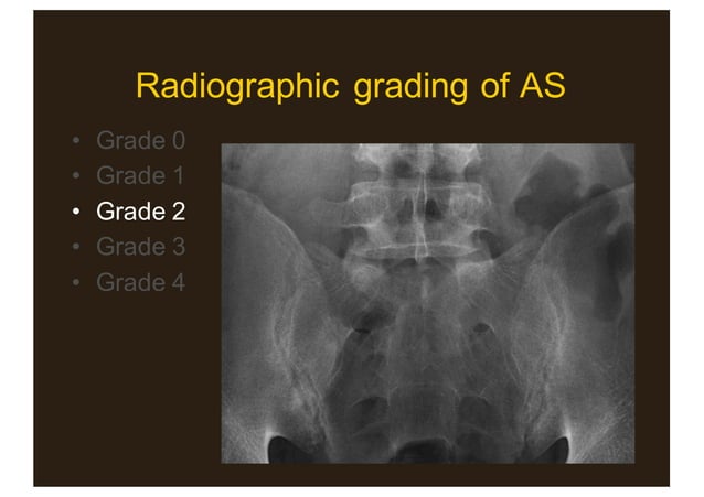 Radiological assessment – Part 2 | PPT