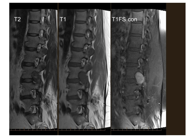 Radiological assessment – Part 2 | PPT