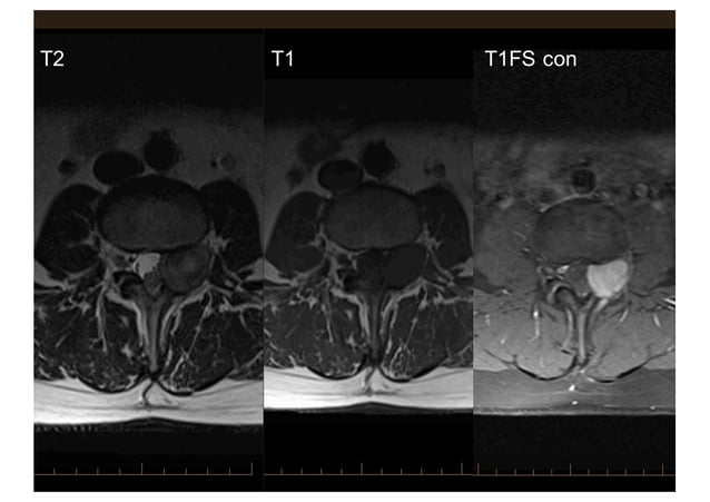 Radiological assessment – Part 2 | PPT