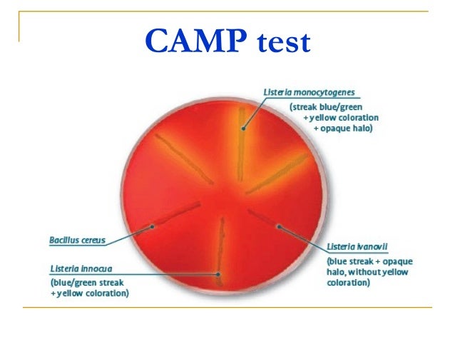 Listeria monocytogens Mandeep Balhara