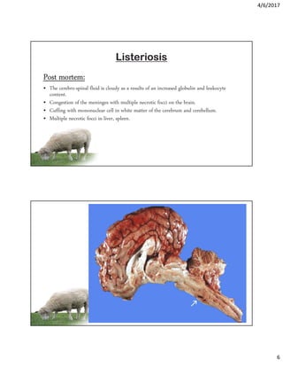 Listeriosis | PDF