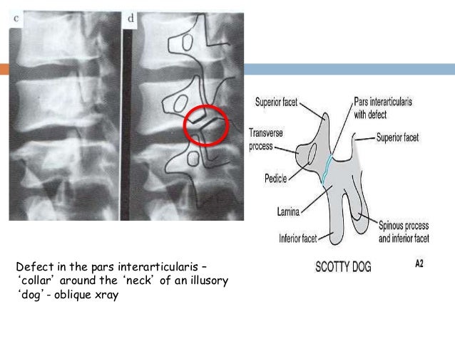 Listhesis (2)