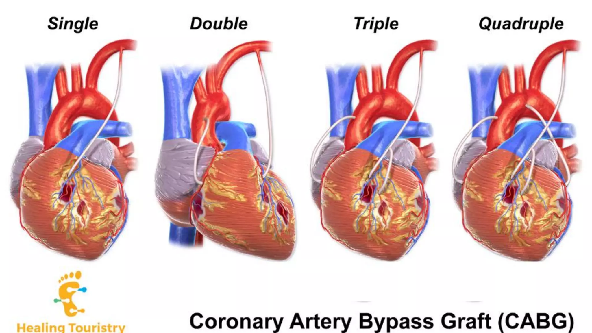 List of most common diseases and conditions information | PPT
