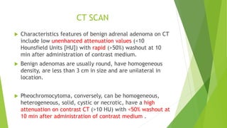 GIANT PHEOCHROMCYTOMA | PPT