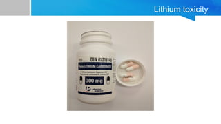 LITHIUM.pptx use history mechanism of action | PPTX