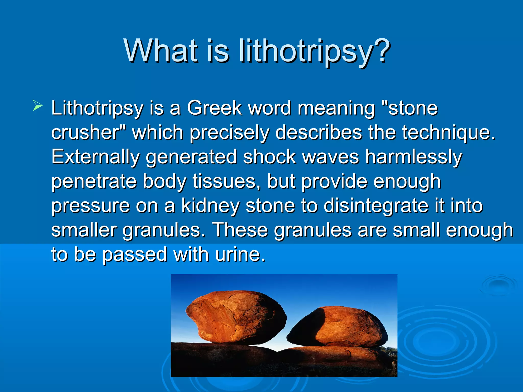 Lithotripsy | PPT