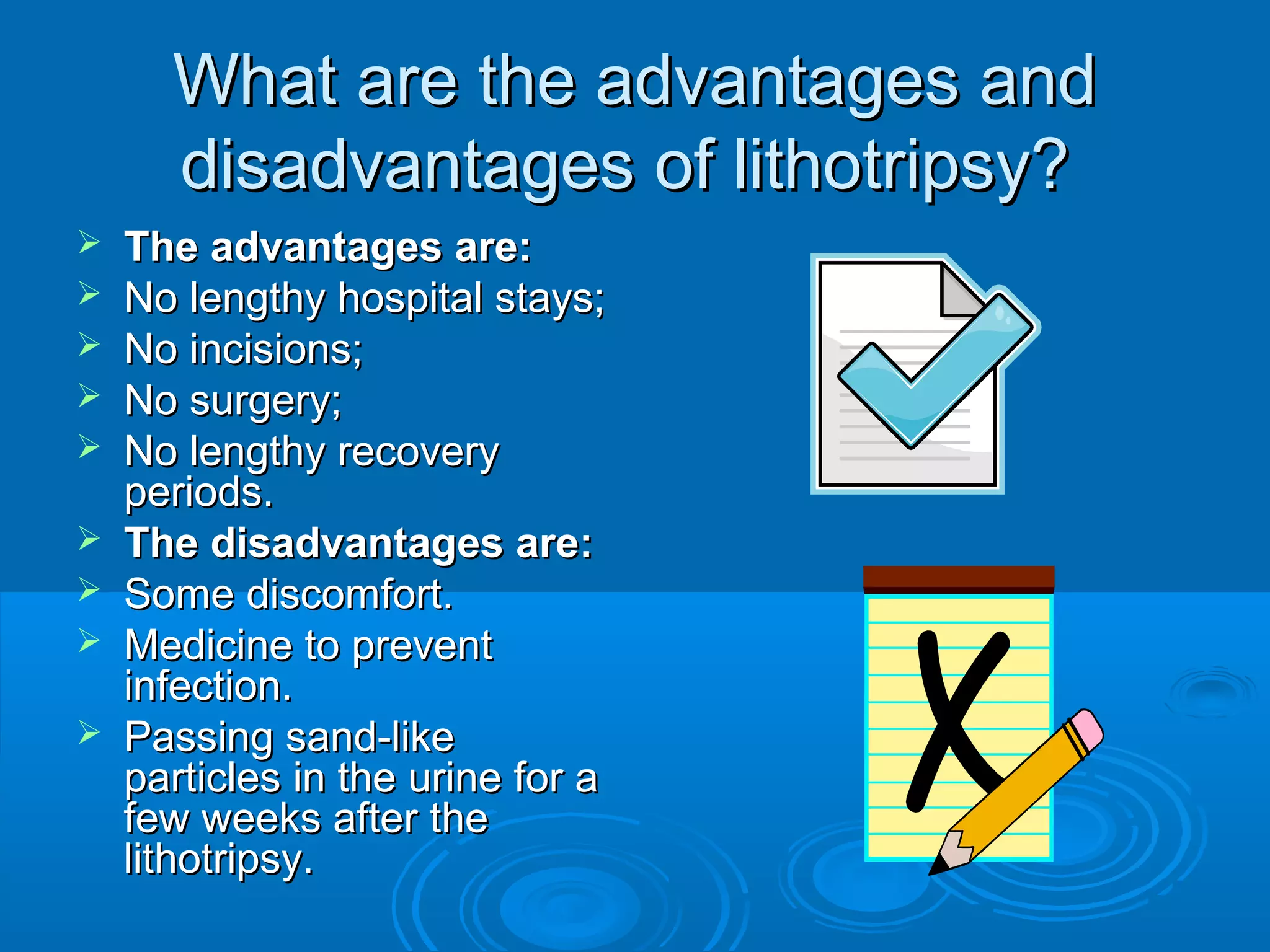 Lithotripsy | PPT