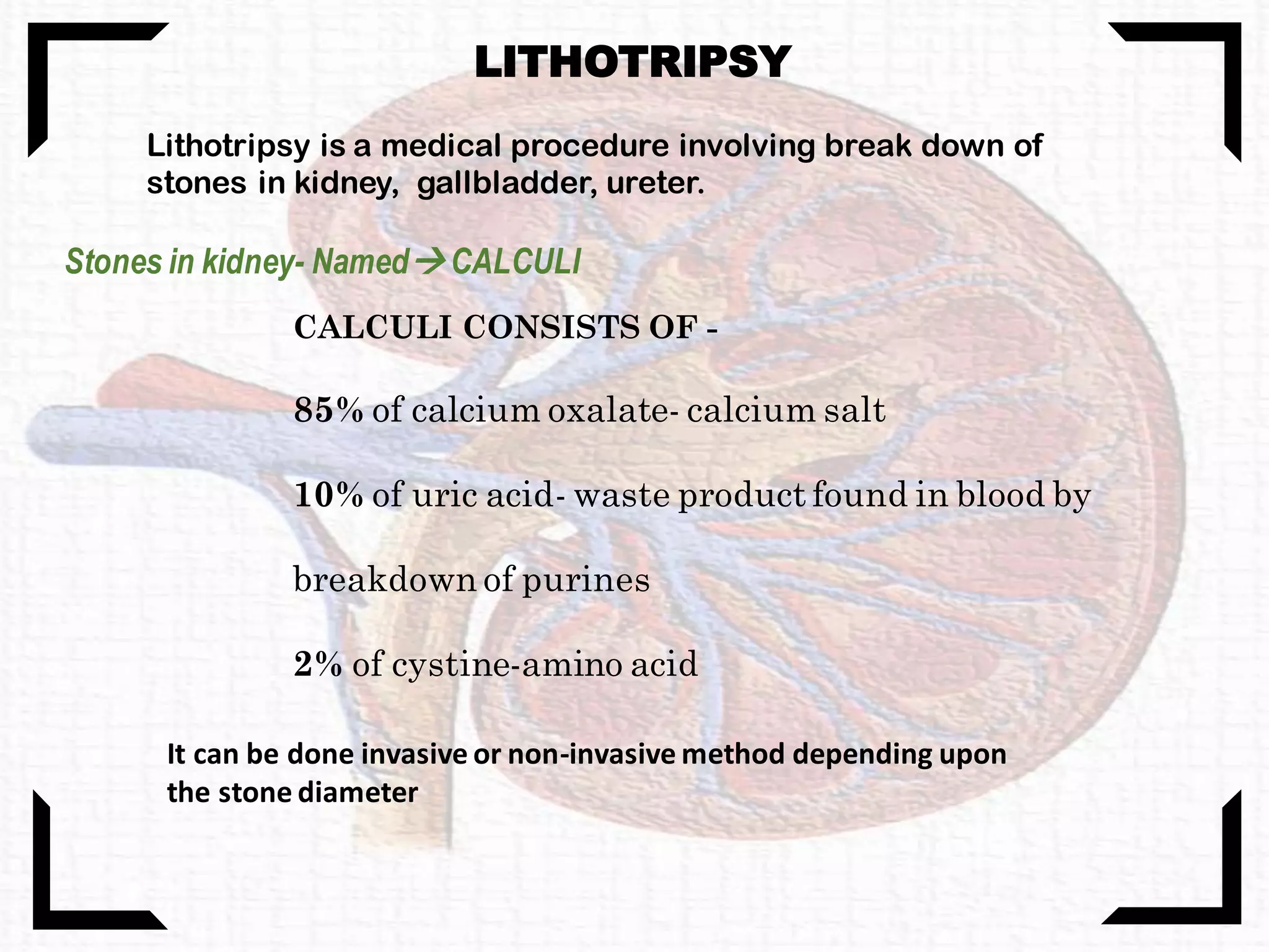 Lithotripsy | PDF