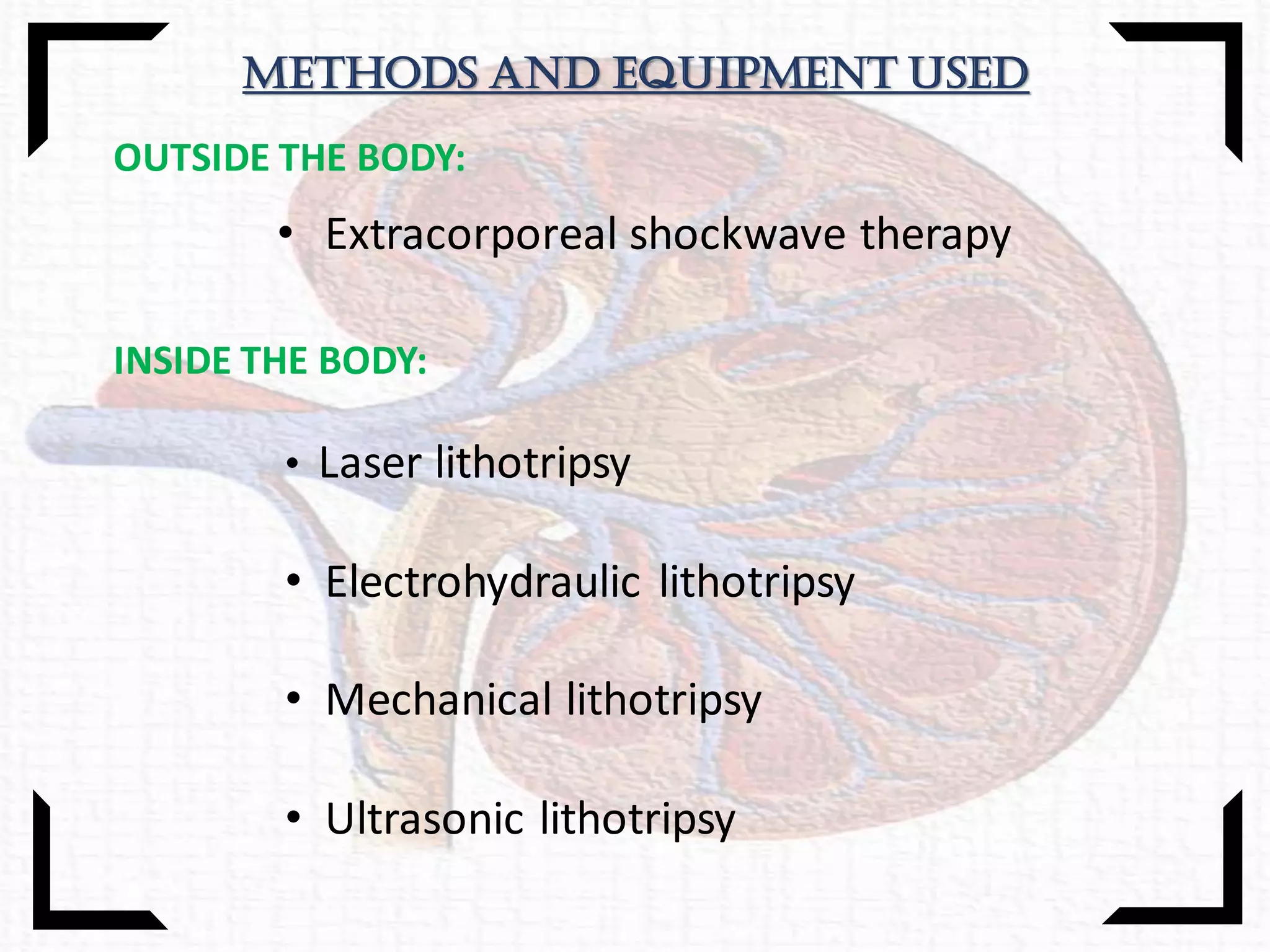Lithotripsy | PDF