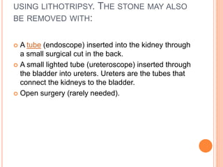 Lithotripsy.pptx | Surgery | Medical Health