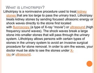 Lithotripsy.pptx