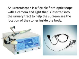Lithotripter.pptx