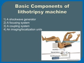 Lithotrypsy | PPT