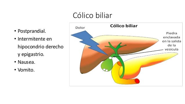 COLICO BILIAR PDF