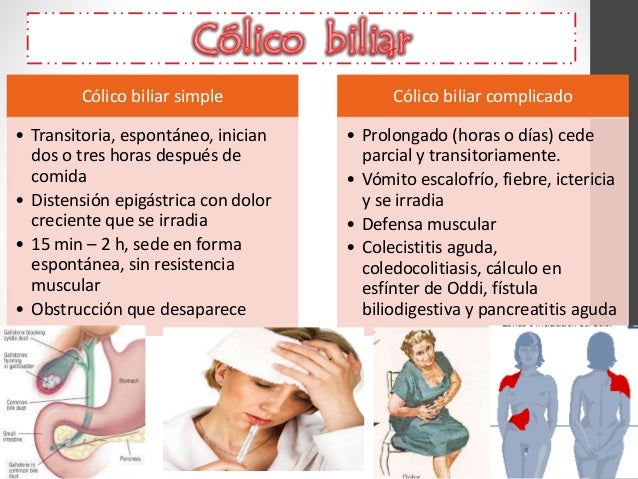 COLICO BILIAR PDF