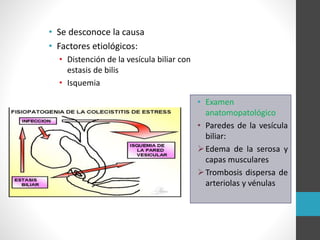Litiasis biliar, Cólico Biliar y Colecistitis Aguda | PPTX