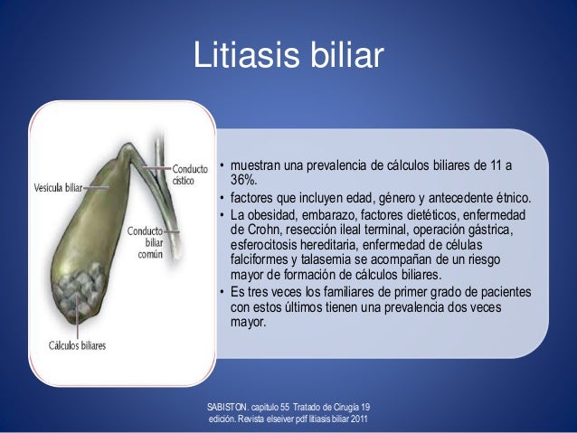 Que Es La Litiasis Biliar – Litiasis biliar. Artículo ...
