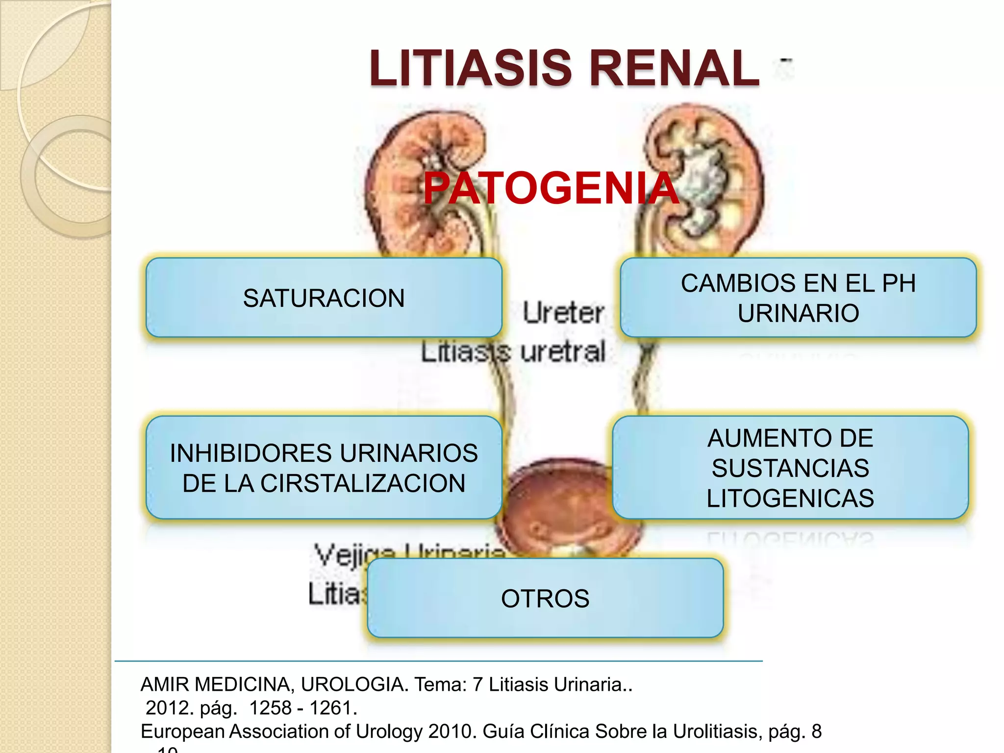 LITIASIS RENAL - DR. FRANCISCO CRUZ TORRES | PPTX