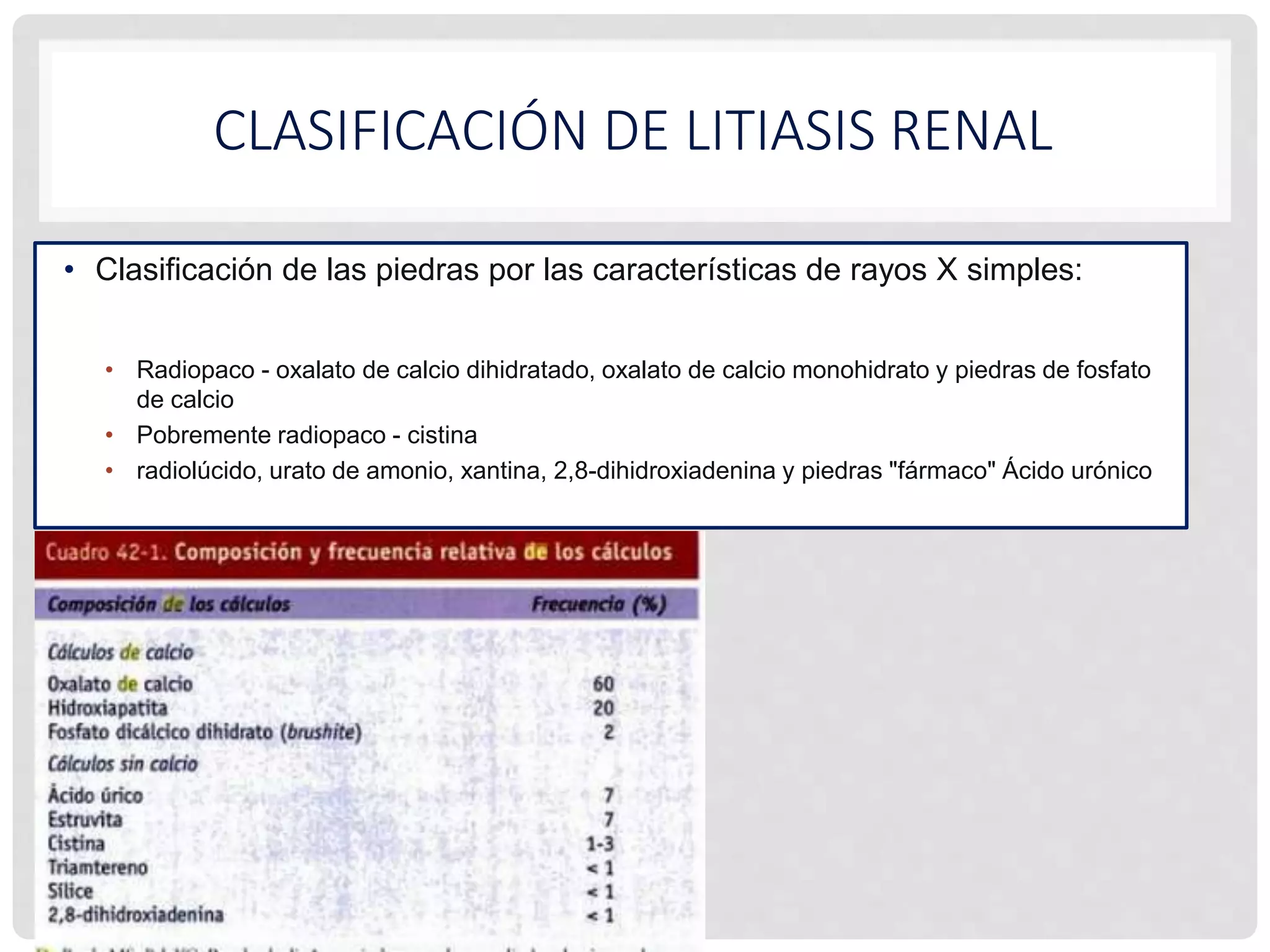 Litiasis renal | PPT