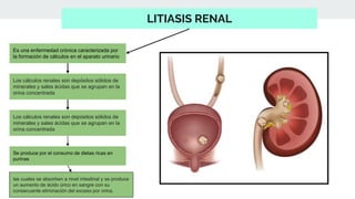 Litiasis Renal.pptx