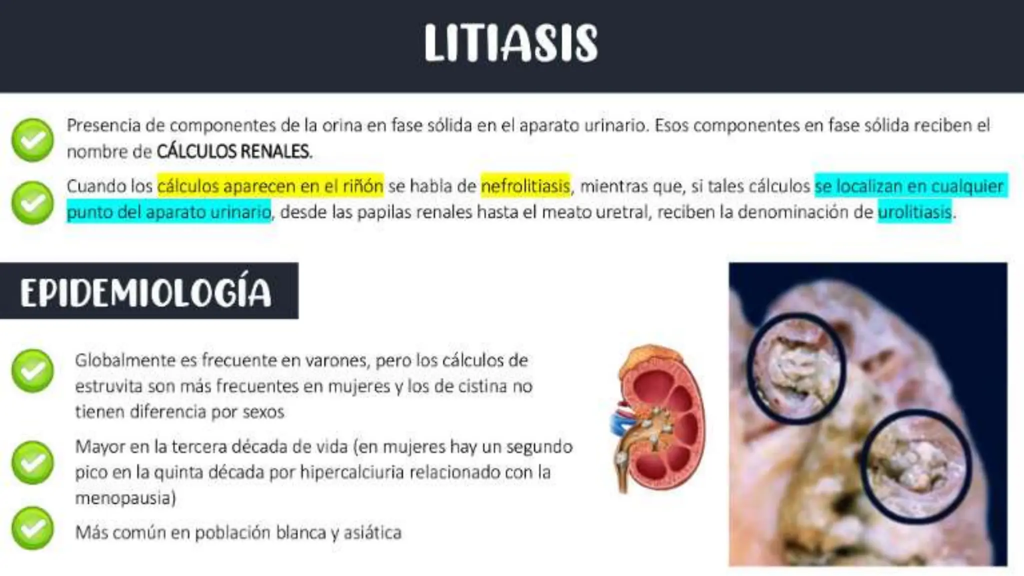PowerPoint de litiasis renal de la UNC.pptx