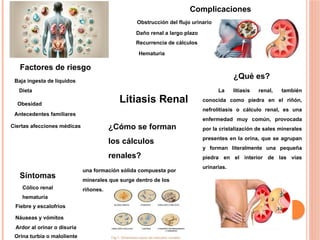 litiasis renal factores de riesgos que influyen a padecer cálculos ...