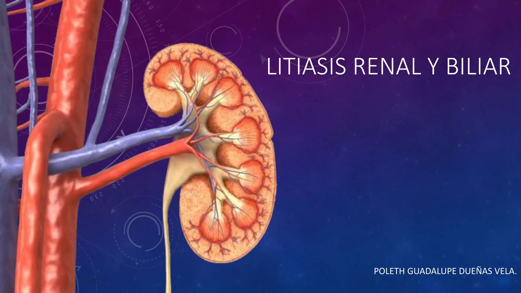 Información Básica sobre Litiasis renal y biliar.pptx
