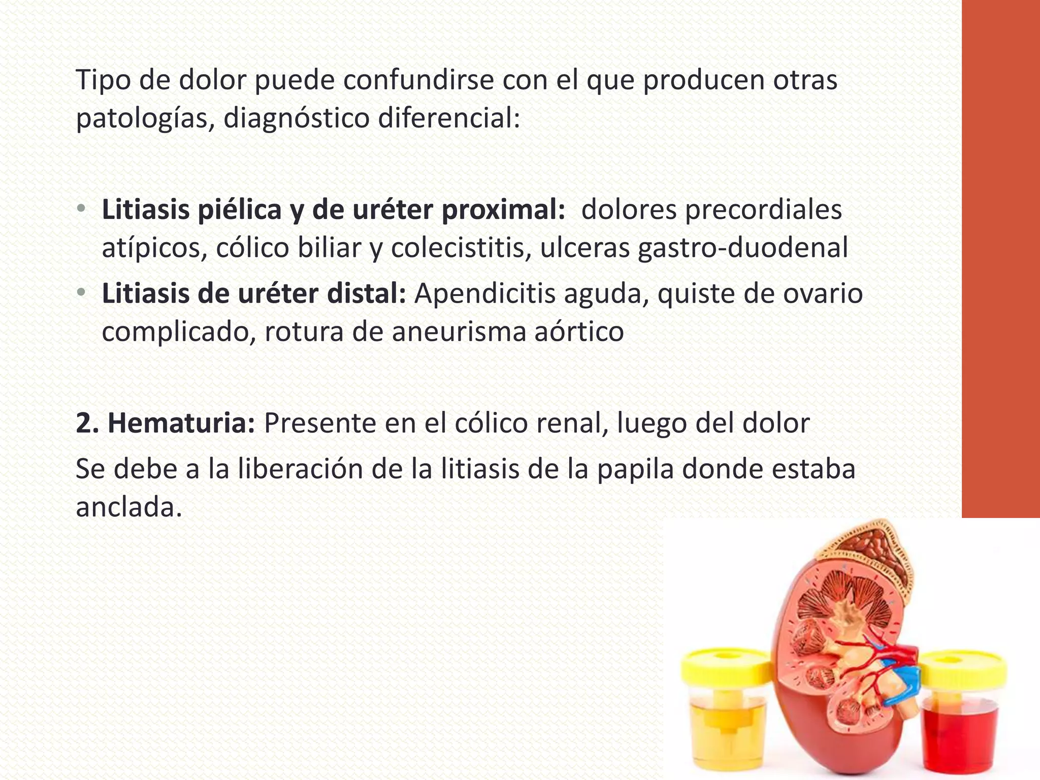 Litiasis urinaria | PPTX