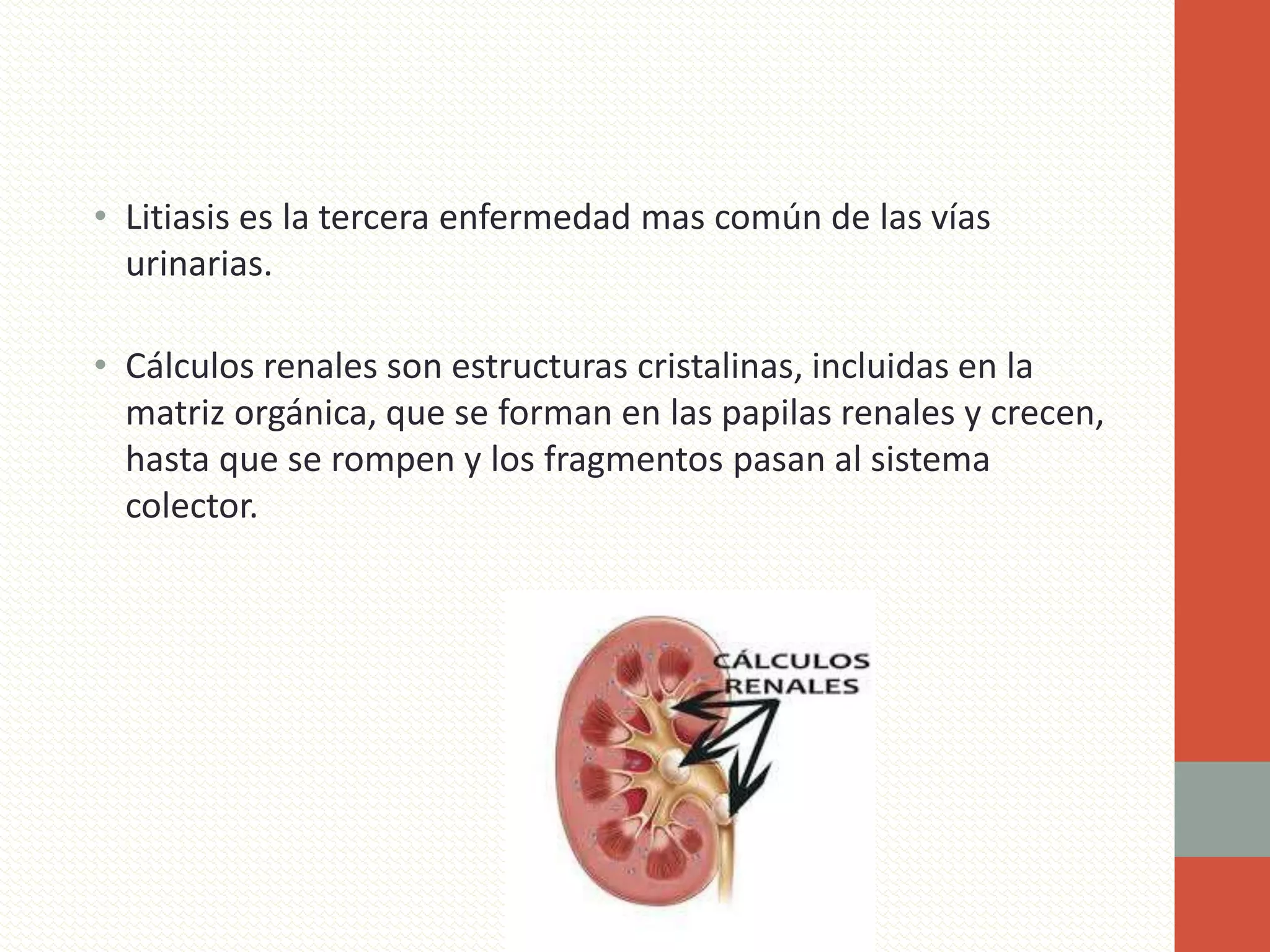 Litiasis urinaria | PPTX
