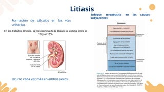 Litiasis urinaria fisiopatología y tratamiento.pptx