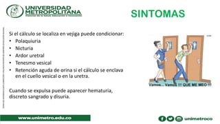 Litiasis urinaria | PPTX