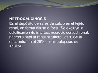 Litiasis Urinaria | PPT