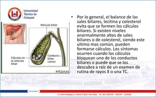 Litiasis y concresiones | PPTX