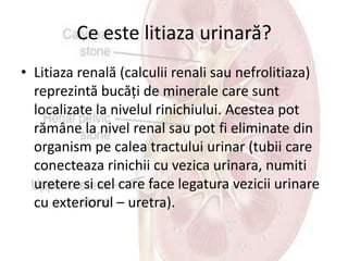 Litiaza urinară | PPTX