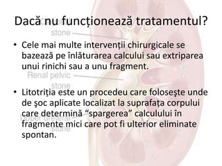 Litiaza urinară | PPTX
