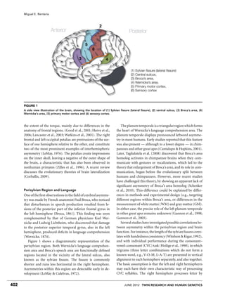 Cerebral Asymmetry: A Quantitative, Multifactorial and Plastic Brain ...