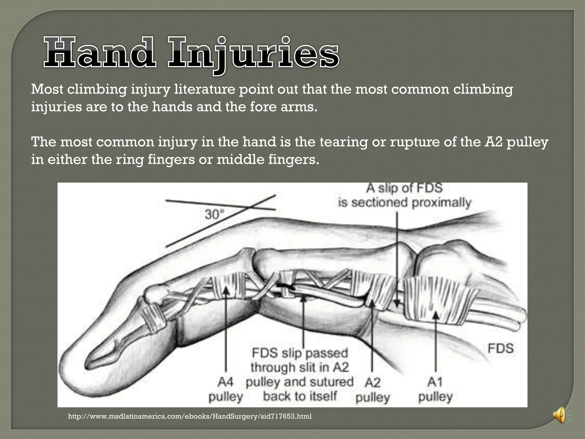 Lit review finger injuries in rock climbers | PPTX