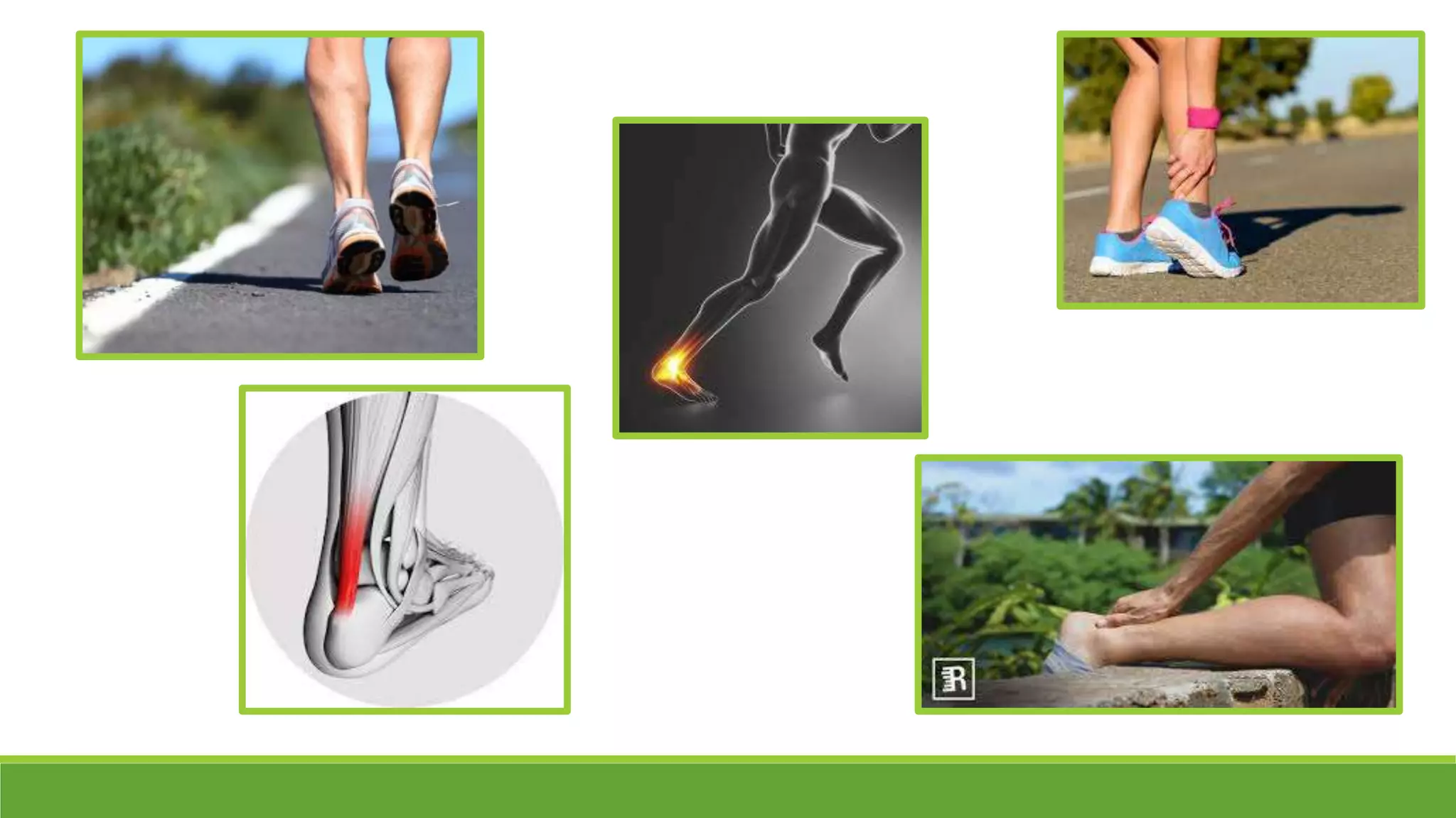 Review of Most Effective Tendon Loading Regimen for Treatment of Non ...