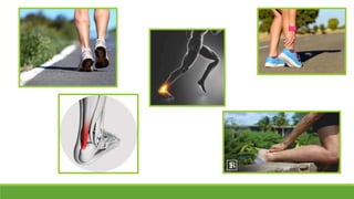 Review of Most Effective Tendon Loading Regimen for Treatment of Non ...