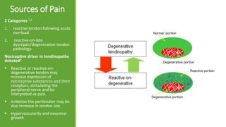 Review of Most Effective Tendon Loading Regimen for Treatment of Non ...