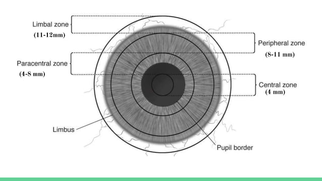 litty keratometry.pptx | Eye and Vision Conditions | Diseases and ...