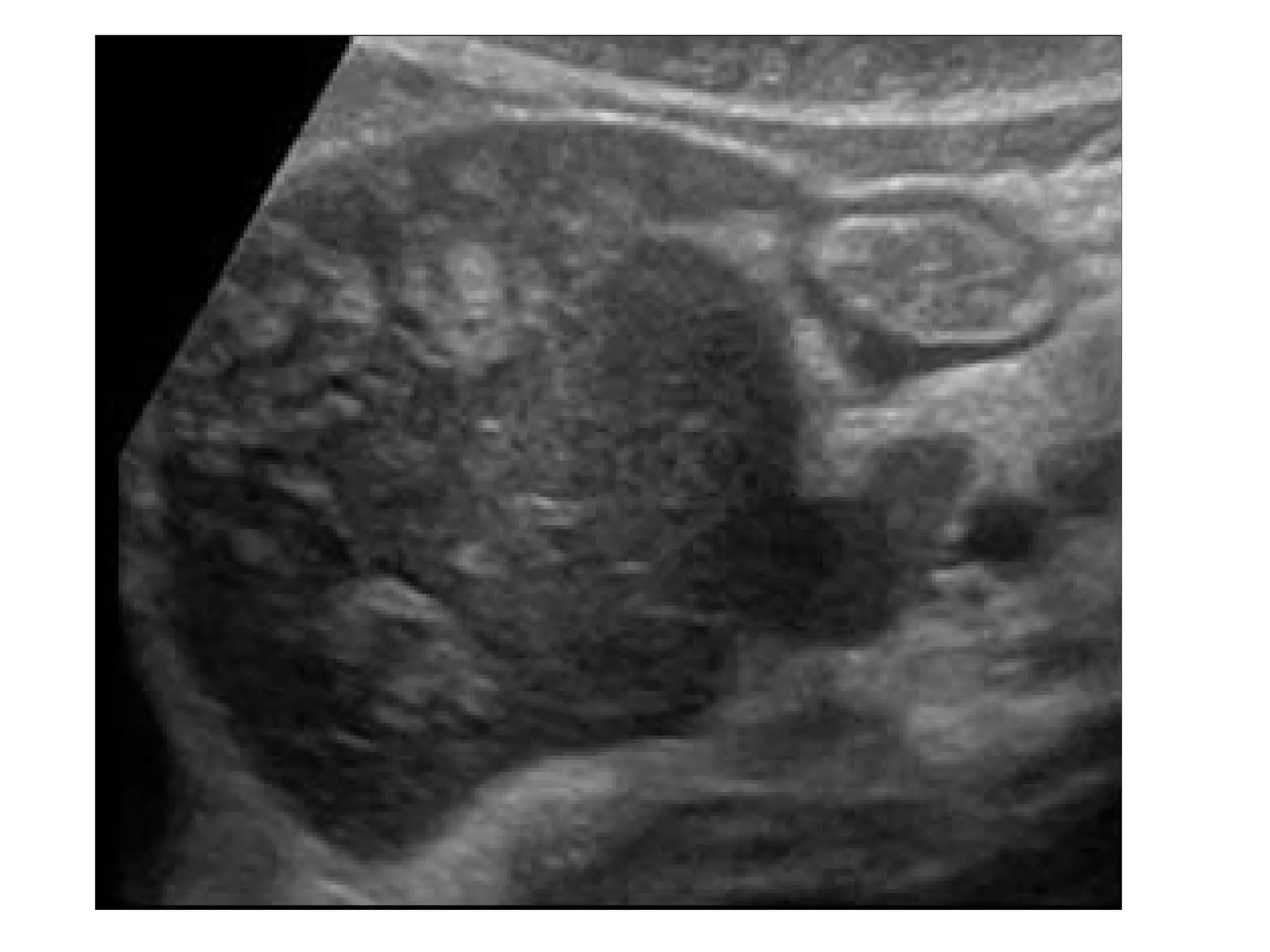 Diagnostic Imaging of the Liver | PPT