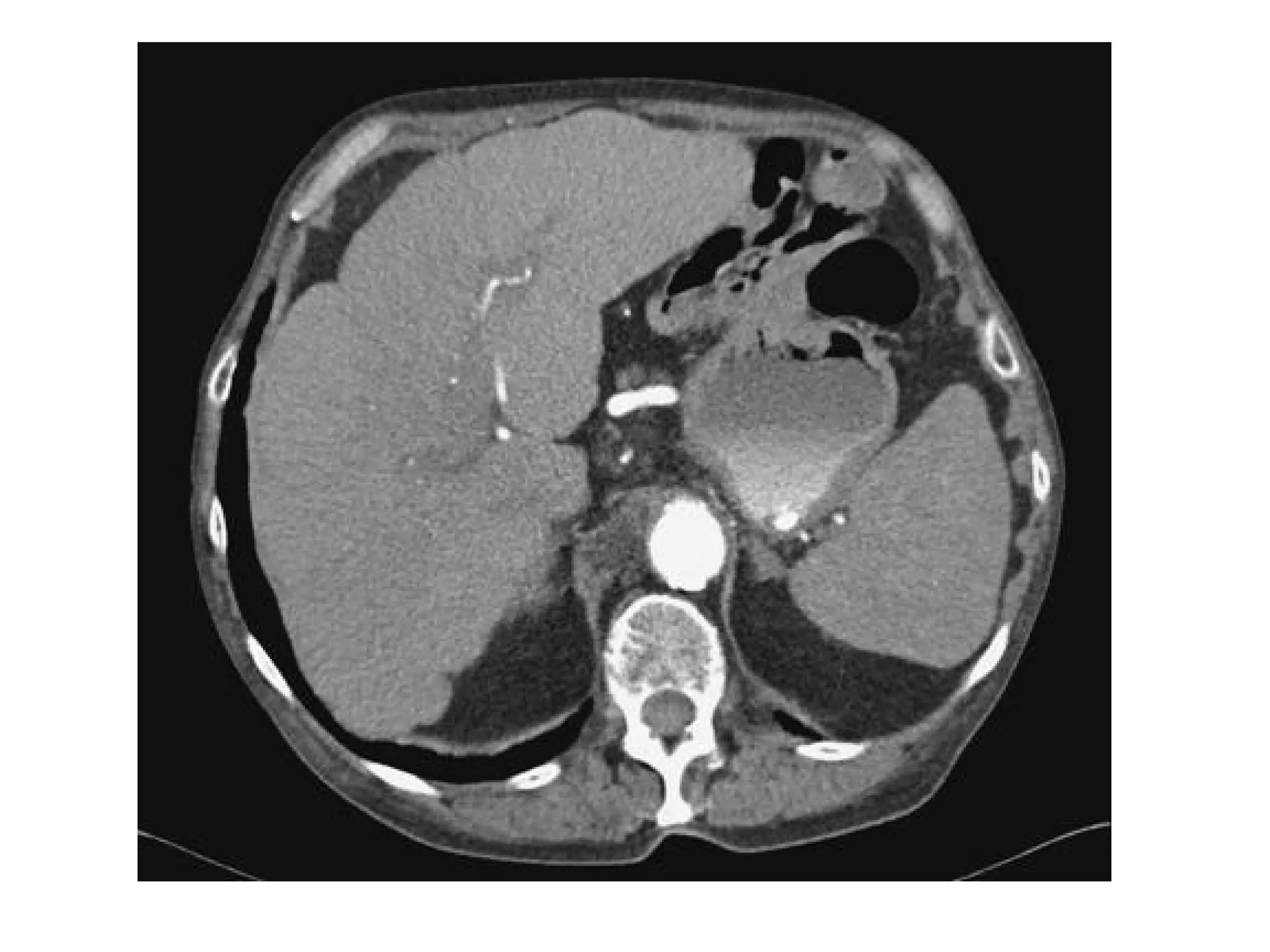 Diagnostic Imaging of the Liver | PPT